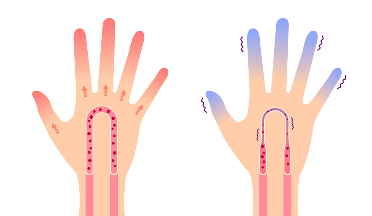 CINCOM's Best Hand Massager with Heat: Hand's Best Friend